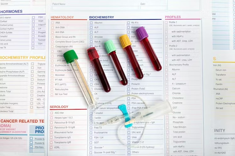 What do your blood test results mean? A toxicologist explains the ...